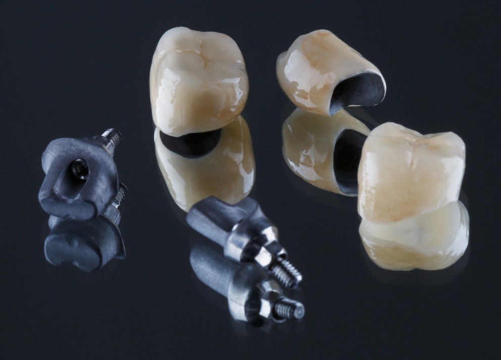 Metal Porcelain Crowns in Turkey | MedicaSmile
