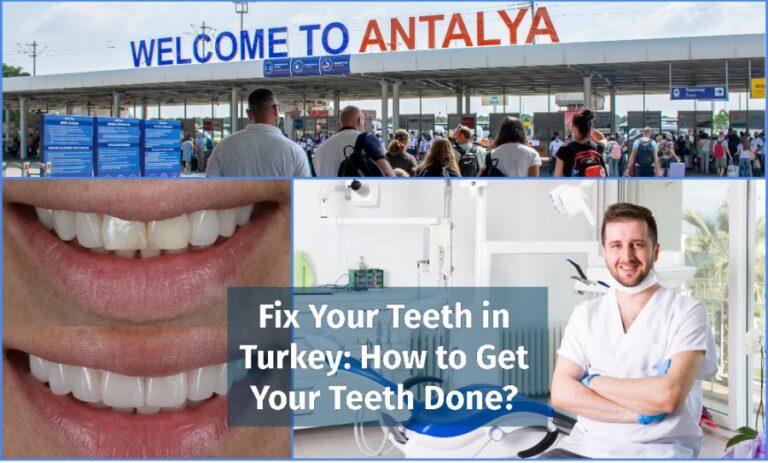 Fix Your Teeth in Turkey: Pros, Prices and Treatments